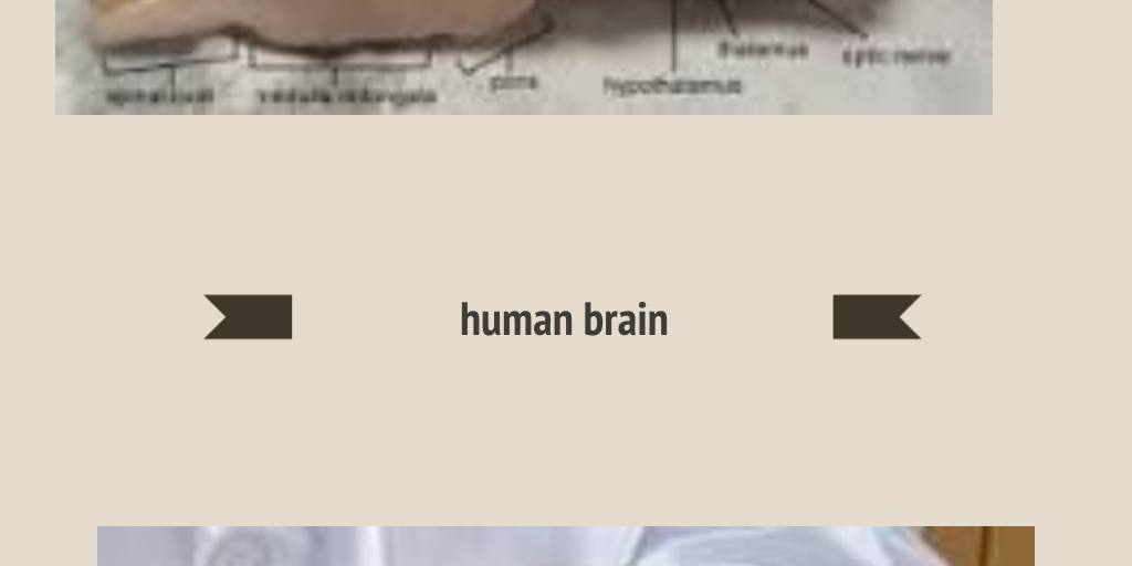 sheep brain vs human brain by Rayce Margelofsky - Infogram