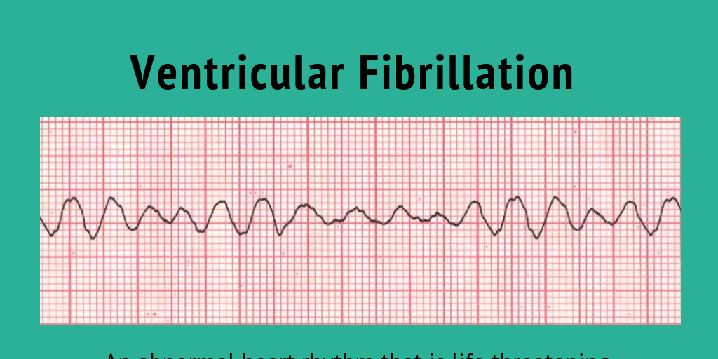 Ocean Sand - Infogram