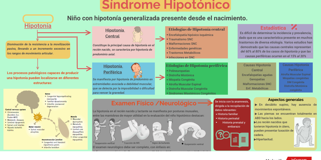 Síndrome Hipotónico by Daniela Cuevas - Infogram