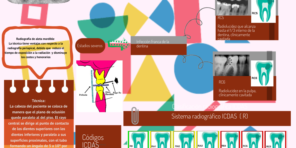 Sistema Radiográfico ICDAS by johana rojas - Infogram
