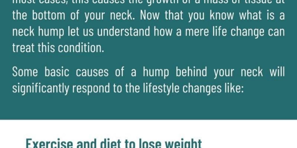 What Is a Neck Hump and How Lifestyle Change Can Help You Get Rid of It ...