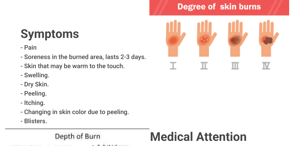 Burns - Infogram