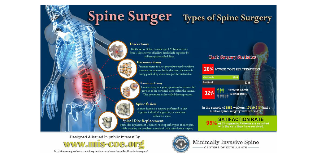 Spine Surgery - Types of Spine Surgery - Infogram