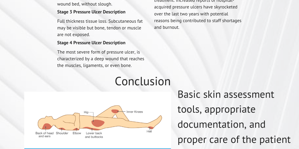 Hospital Acquired Pressure Ulcer Prevention - Infogram