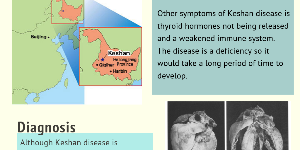 Keshan's Disease by Cassie Deen - Infogram