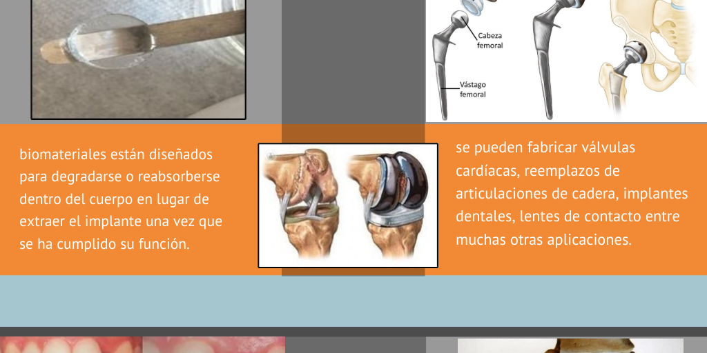 ¿Cómo se utilizan los biomateriales en la práctica médica actual? by ...