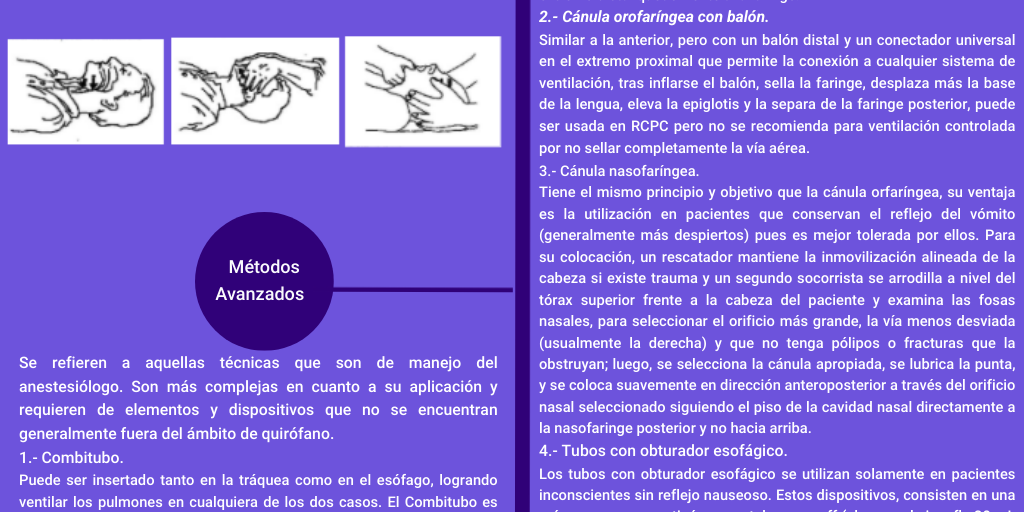 METODOS EN LA VIA AEREA by Abril Estefanía Gonzalez Duran - Infogram