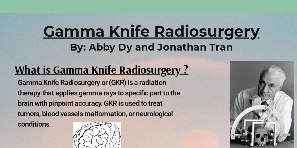 Gamma Knife Radiosurgery by Jonathan Tran - Infogram