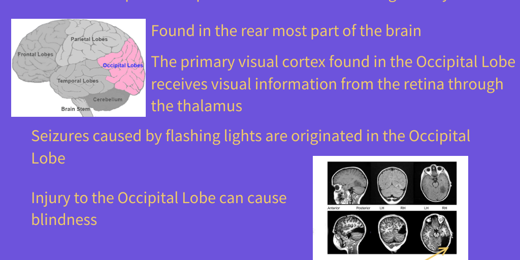 The Occipital Lobe Infographic by William Zinckgraf - Infogram